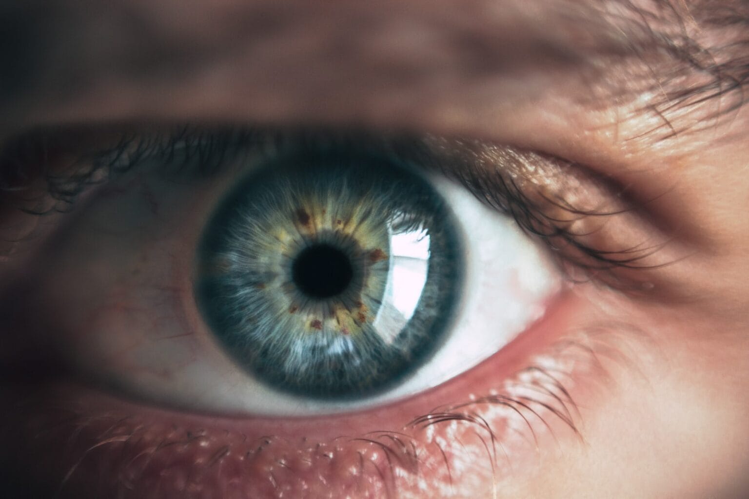 Treatment and Prevention of Eye Floaters - Causes and Risk Factors